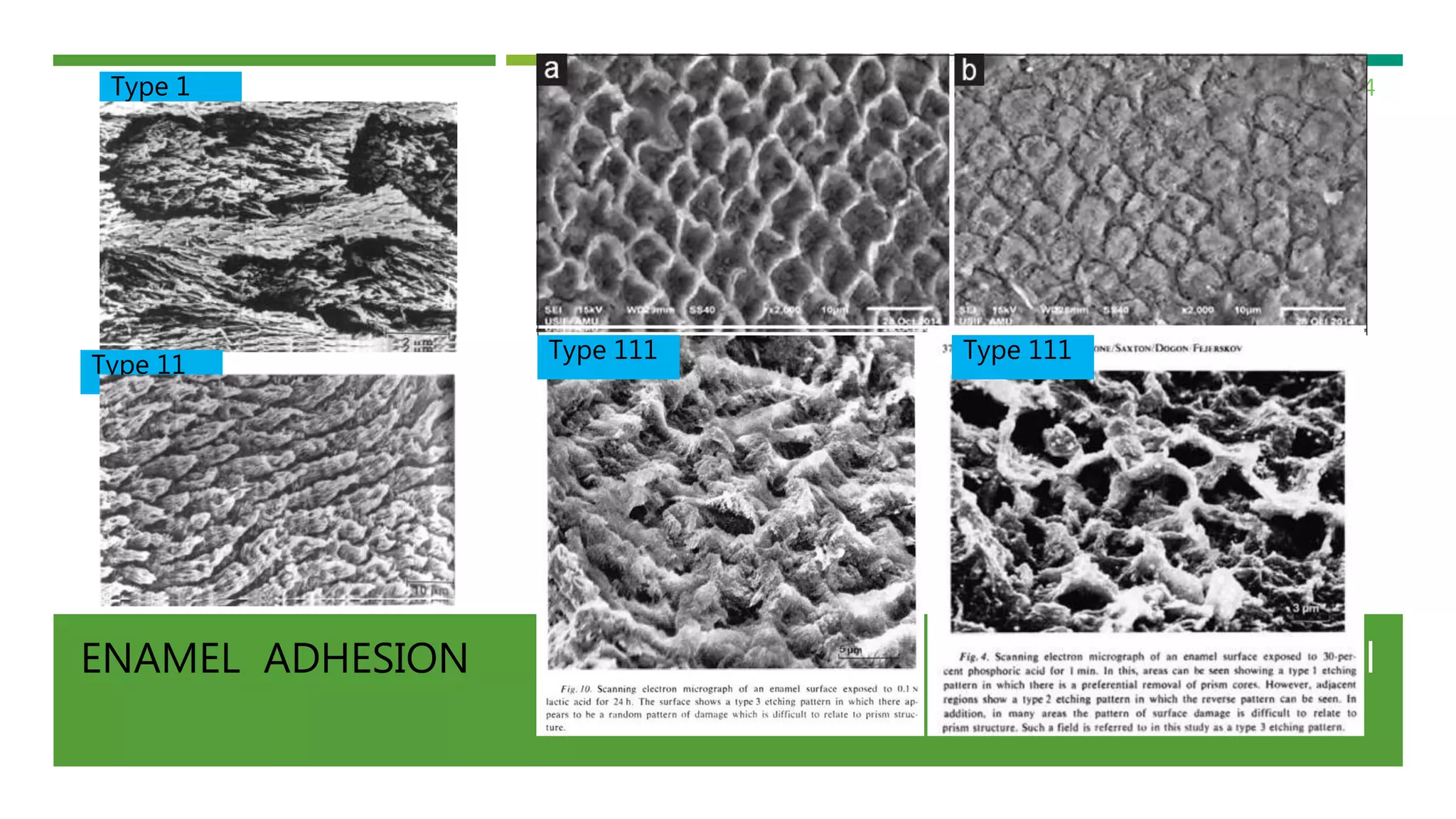 Adhesion & Bonding in Dentistry | PPTX