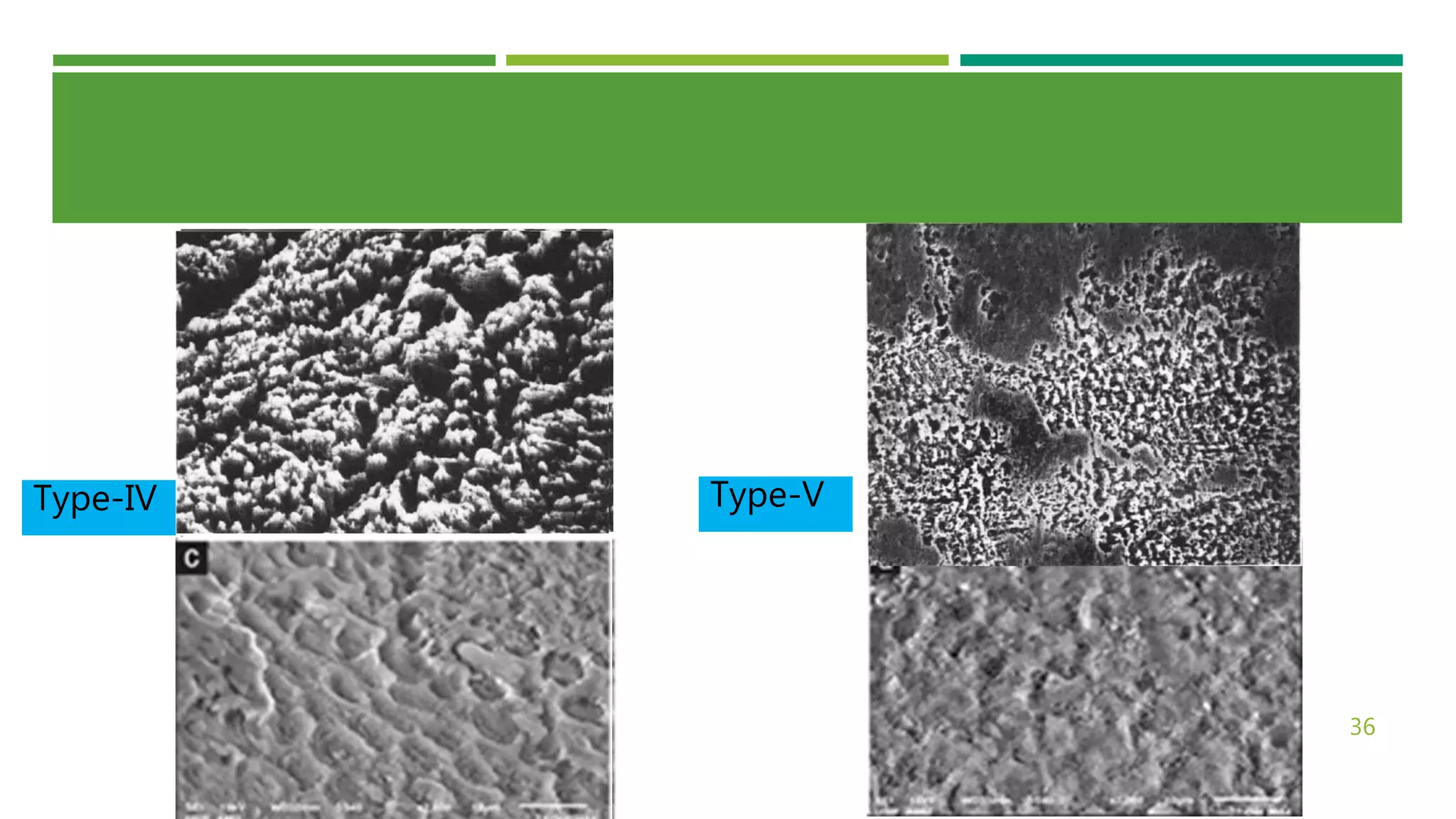 Adhesion & Bonding in Dentistry | PPTX