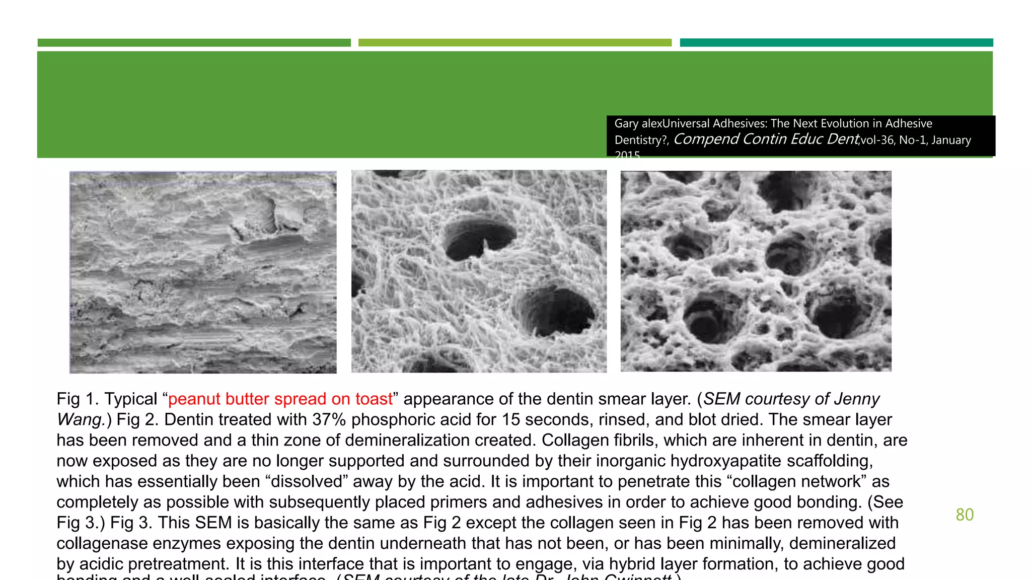 Adhesion & Bonding in Dentistry | PPTX