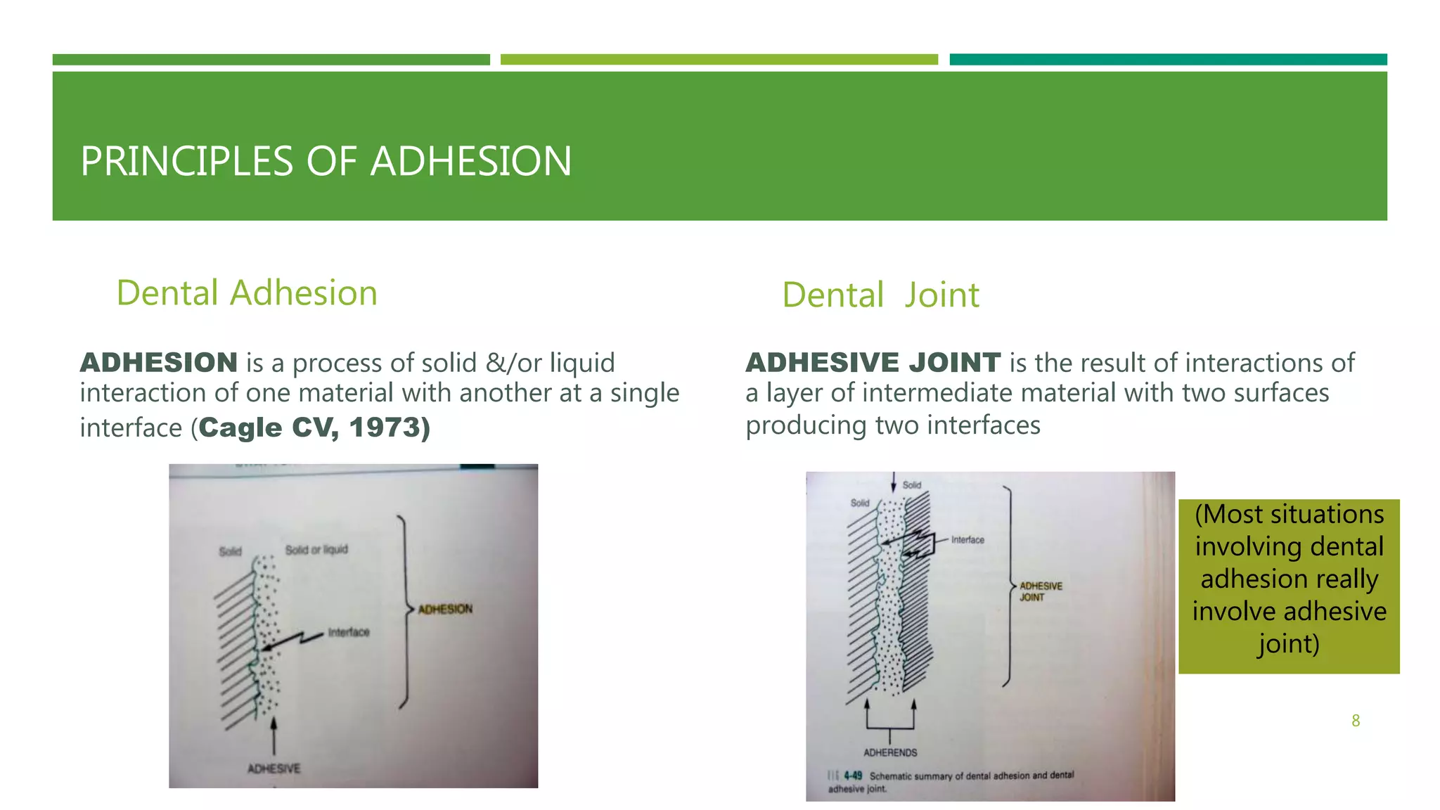 Adhesion & Bonding in Dentistry | PPTX