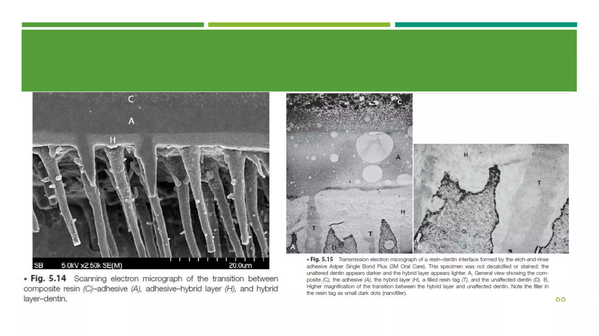 Adhesion & Bonding in Dentistry | PPTX