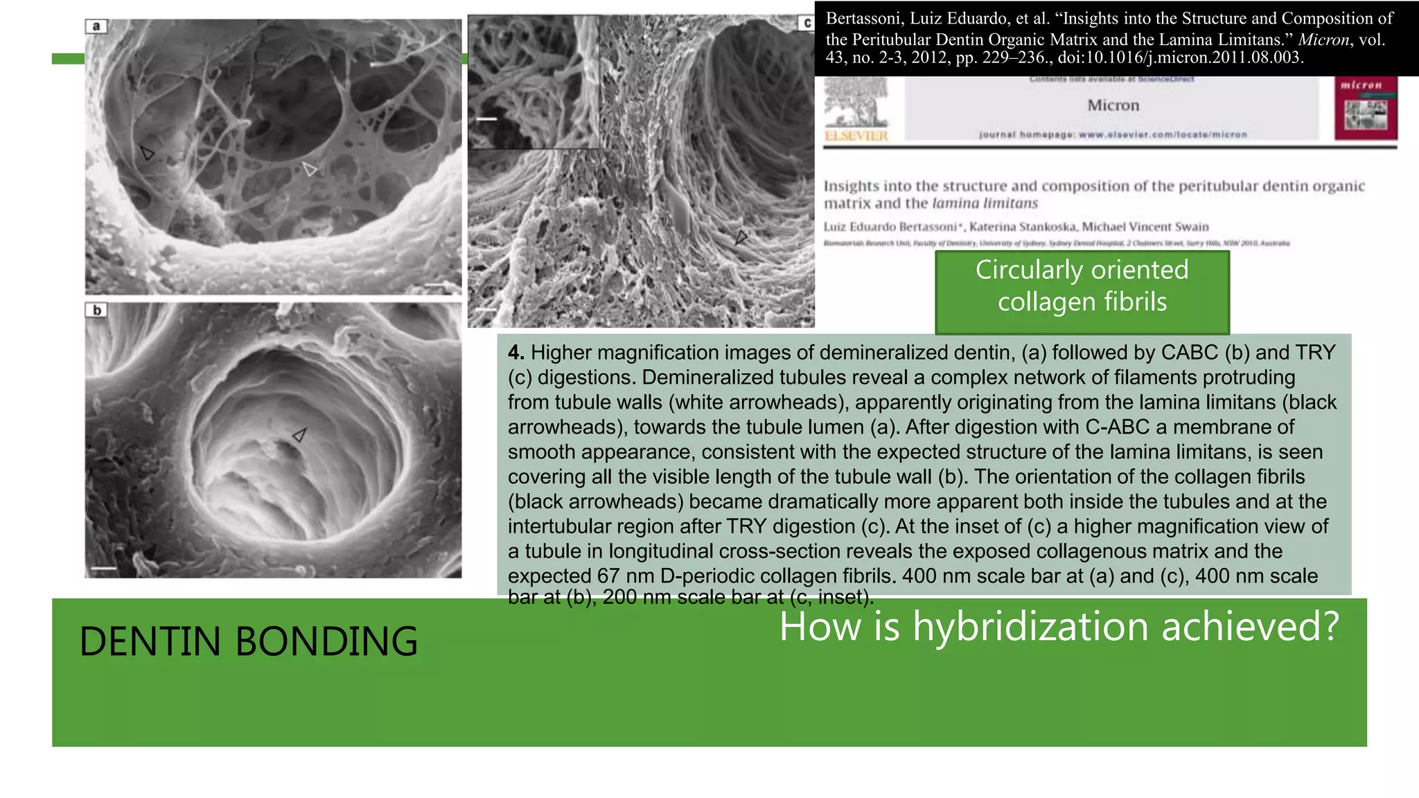Adhesion & Bonding in Dentistry | PPTX