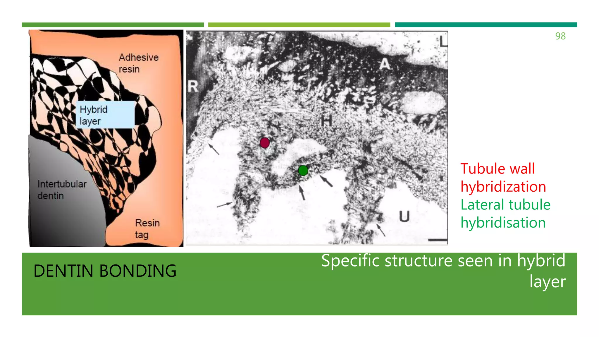 Adhesion & Bonding in Dentistry | PPTX
