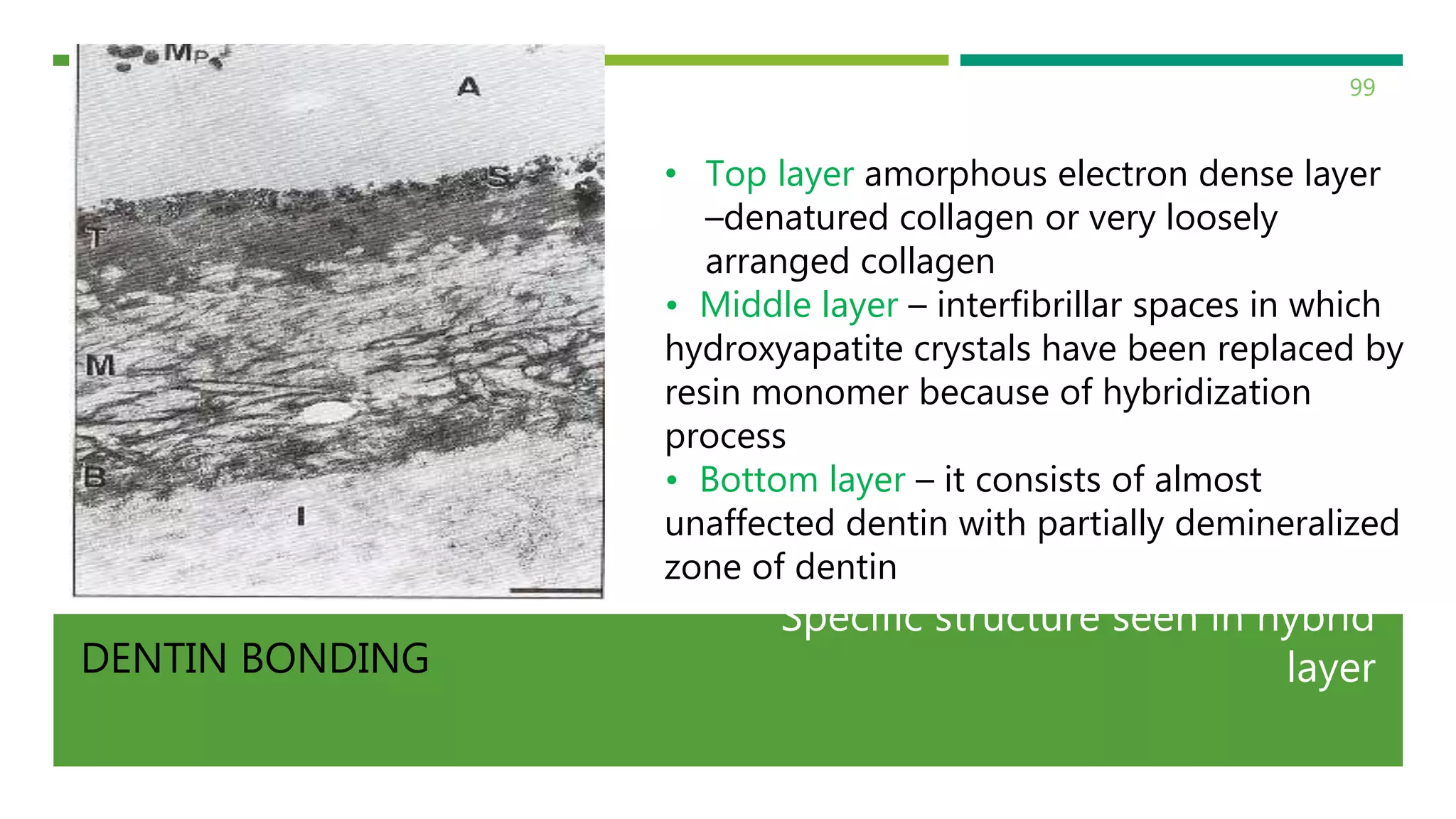 Adhesion & Bonding in Dentistry | PPTX