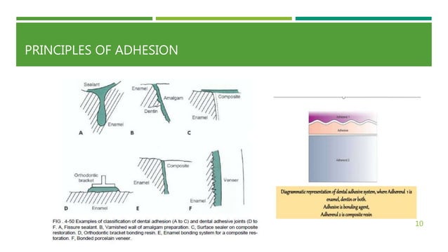 Adhesion & Bonding in Dentistry | PPTX | Dental Health | Diseases and ...