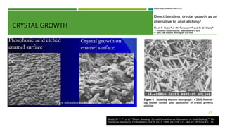 Adhesion & Bonding in Dentistry | PPTX