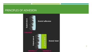 Adhesion & Bonding in Dentistry | PPTX
