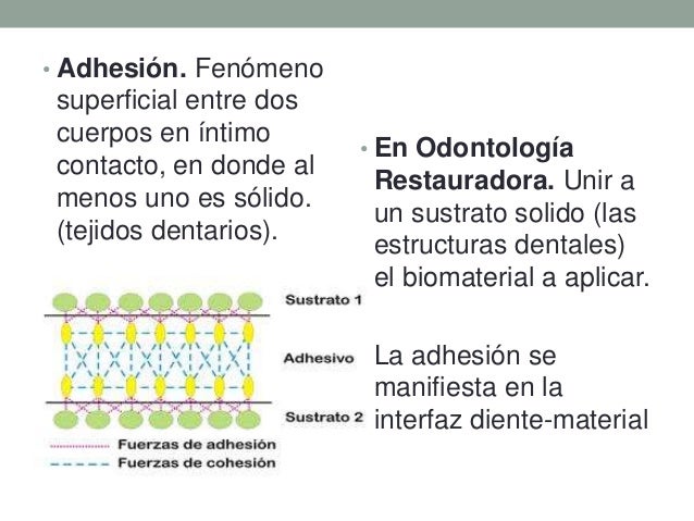 Adhesión dental
