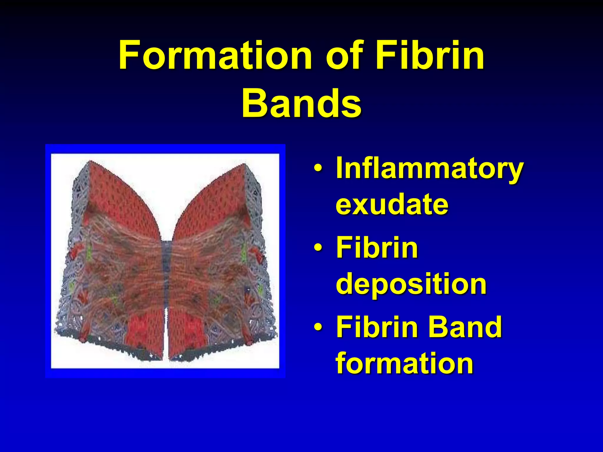 Adhesion prevention in peritoneal surgery | PPT