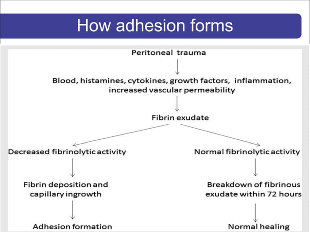What Are Adhesions | PPT