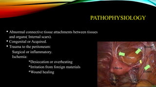 Adhesion prevention techniques | PPTX | Digestive Disorders | Diseases ...