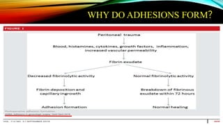 Adhesion prevention techniques | PPTX