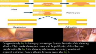 Adhesion prevention techniques | PPTX