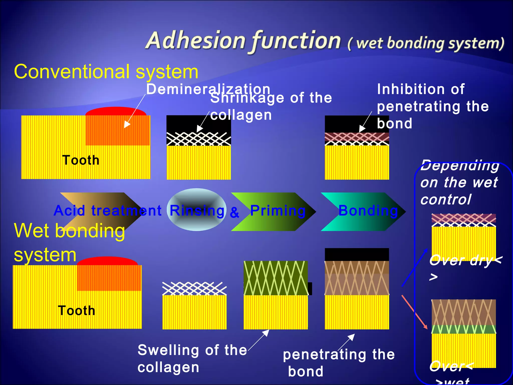 Adhesion strategies to tooth | PPT