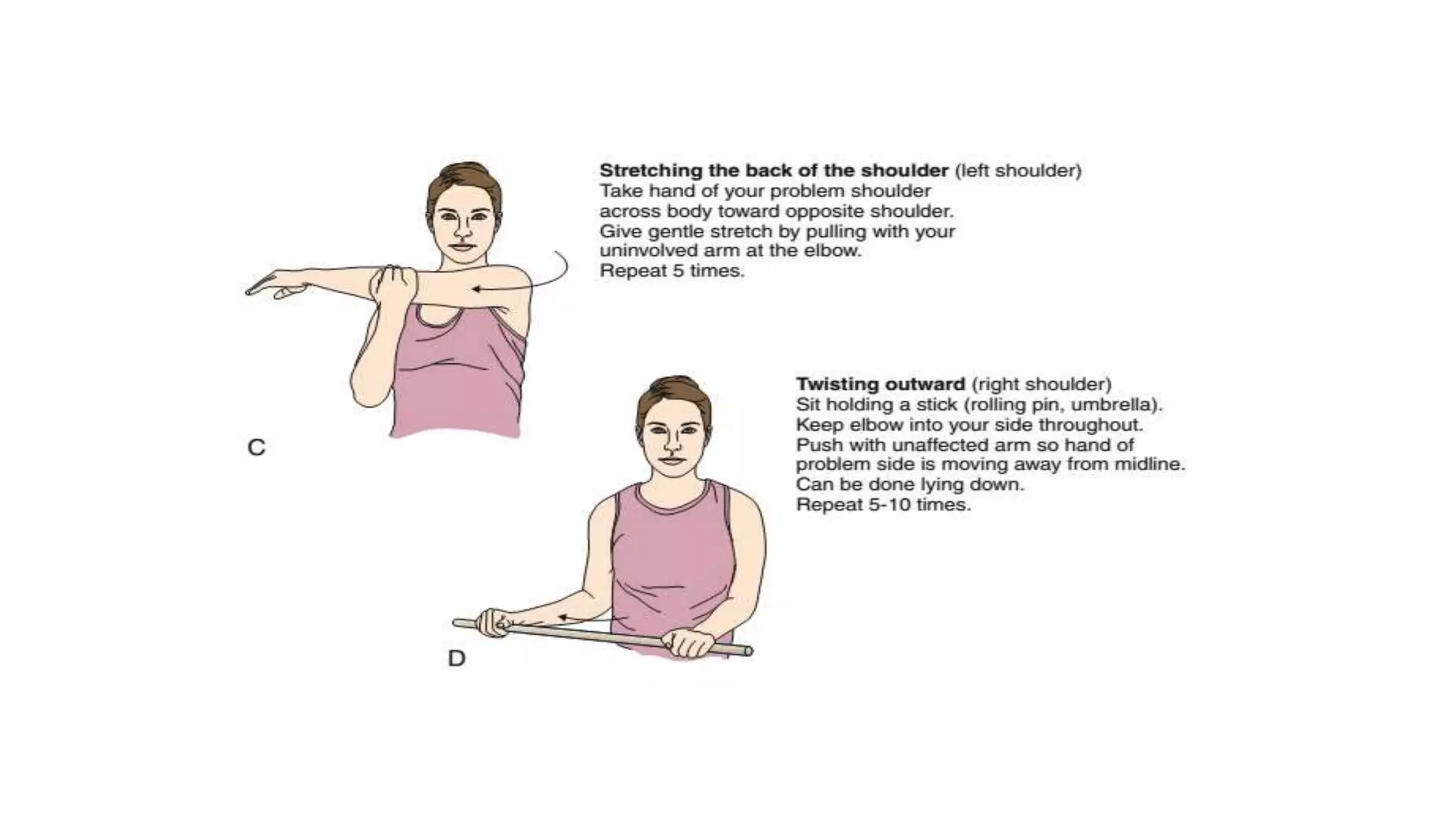 Adhesive capsulitis | PPTX