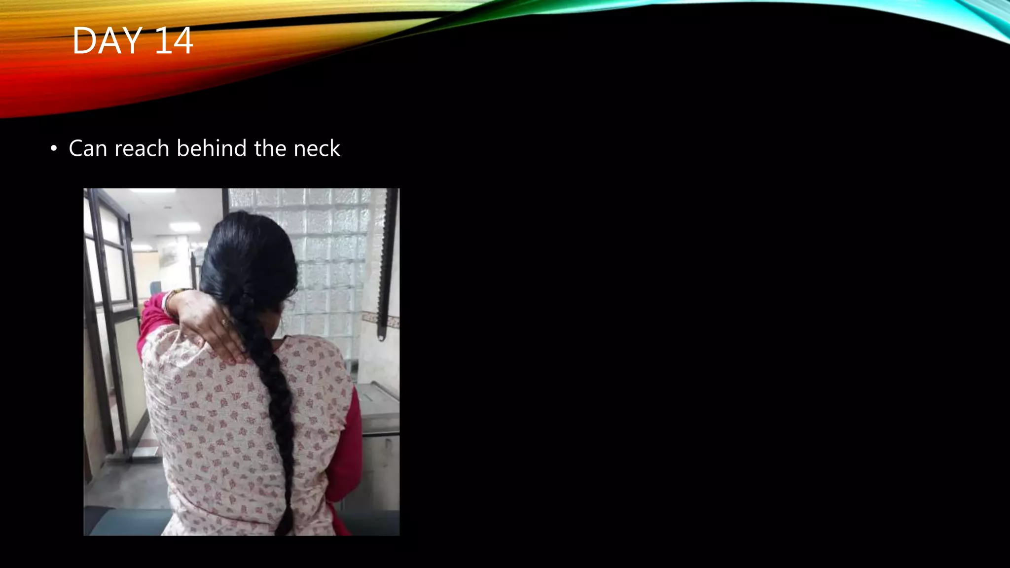 Adhesive capsulitis case presentation physiotherapy | PPTX