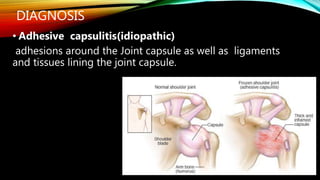 Adhesive capsulitis case presentation physiotherapy | PPTX | Death ...