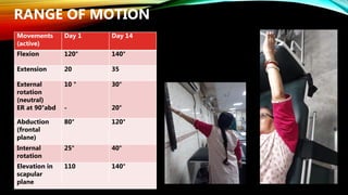 Adhesive capsulitis case presentation physiotherapy | PPTX
