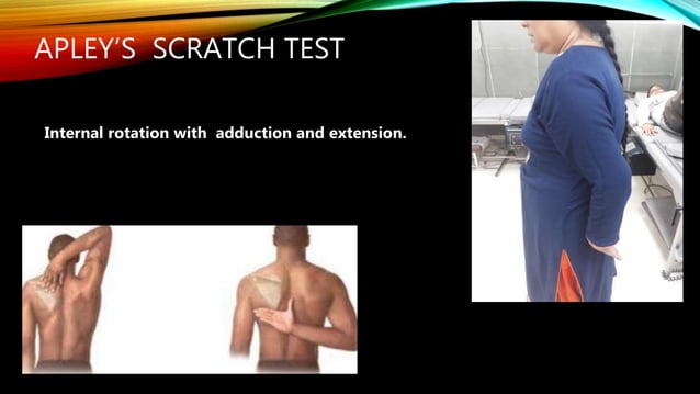 Adhesive capsulitis case presentation physiotherapy