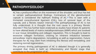 Adhesive capsulitis (Frozen Shoulder)-review on an inflammatory ...