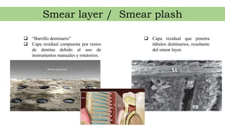 ADHESIVOS DENTALES.pptx