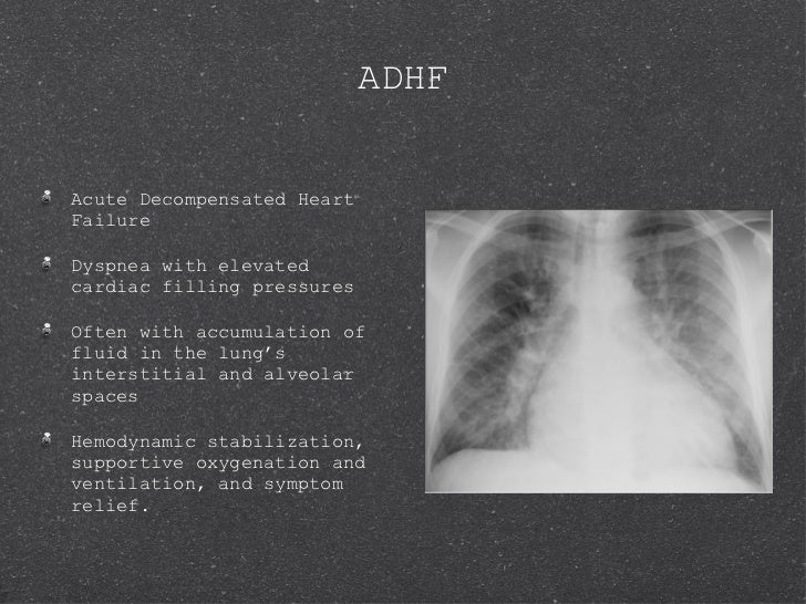 Adhf lecture