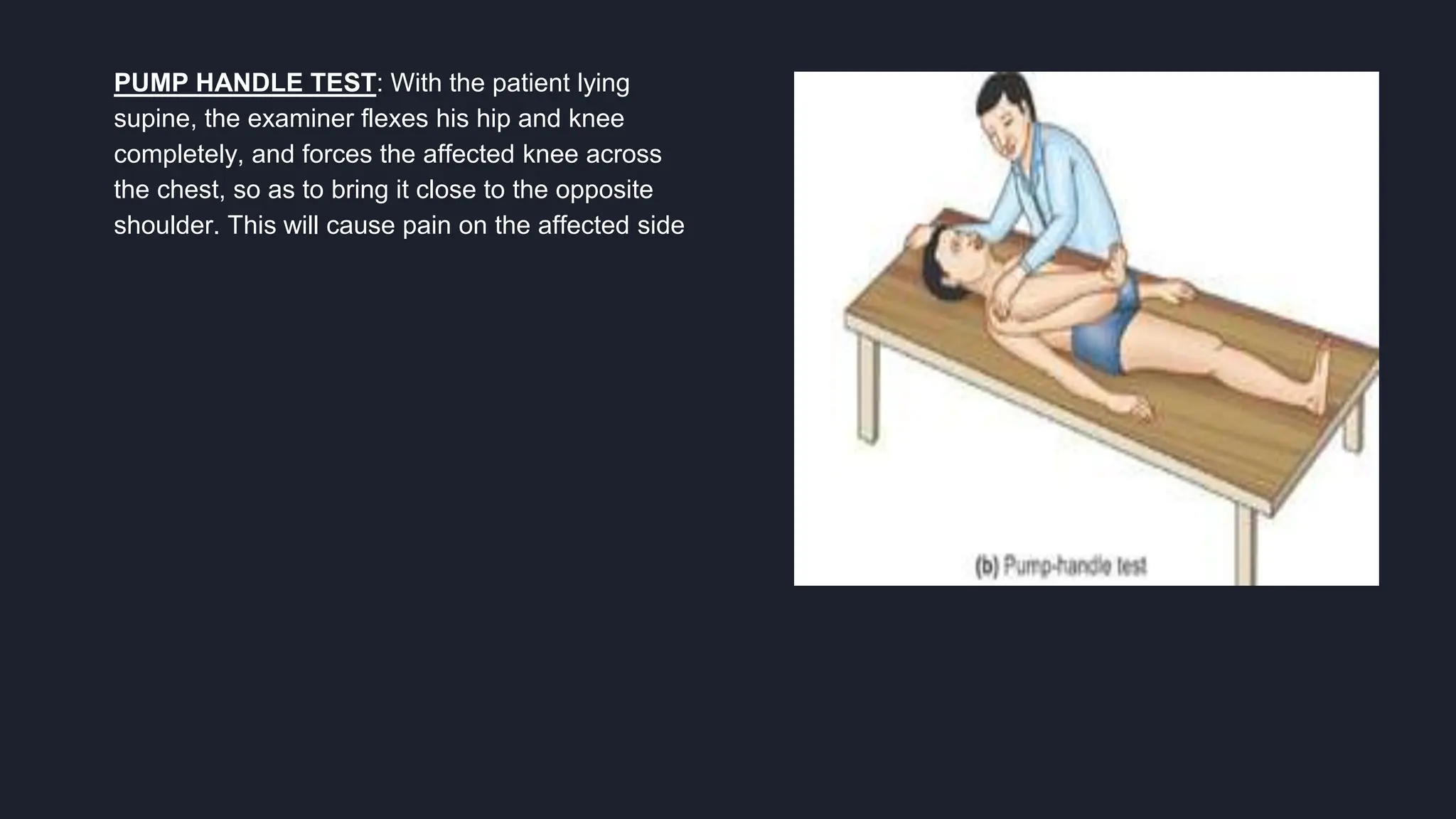 ANKYLOSING SPONDYLITIShhhhhhhhhhhhh.pptx
