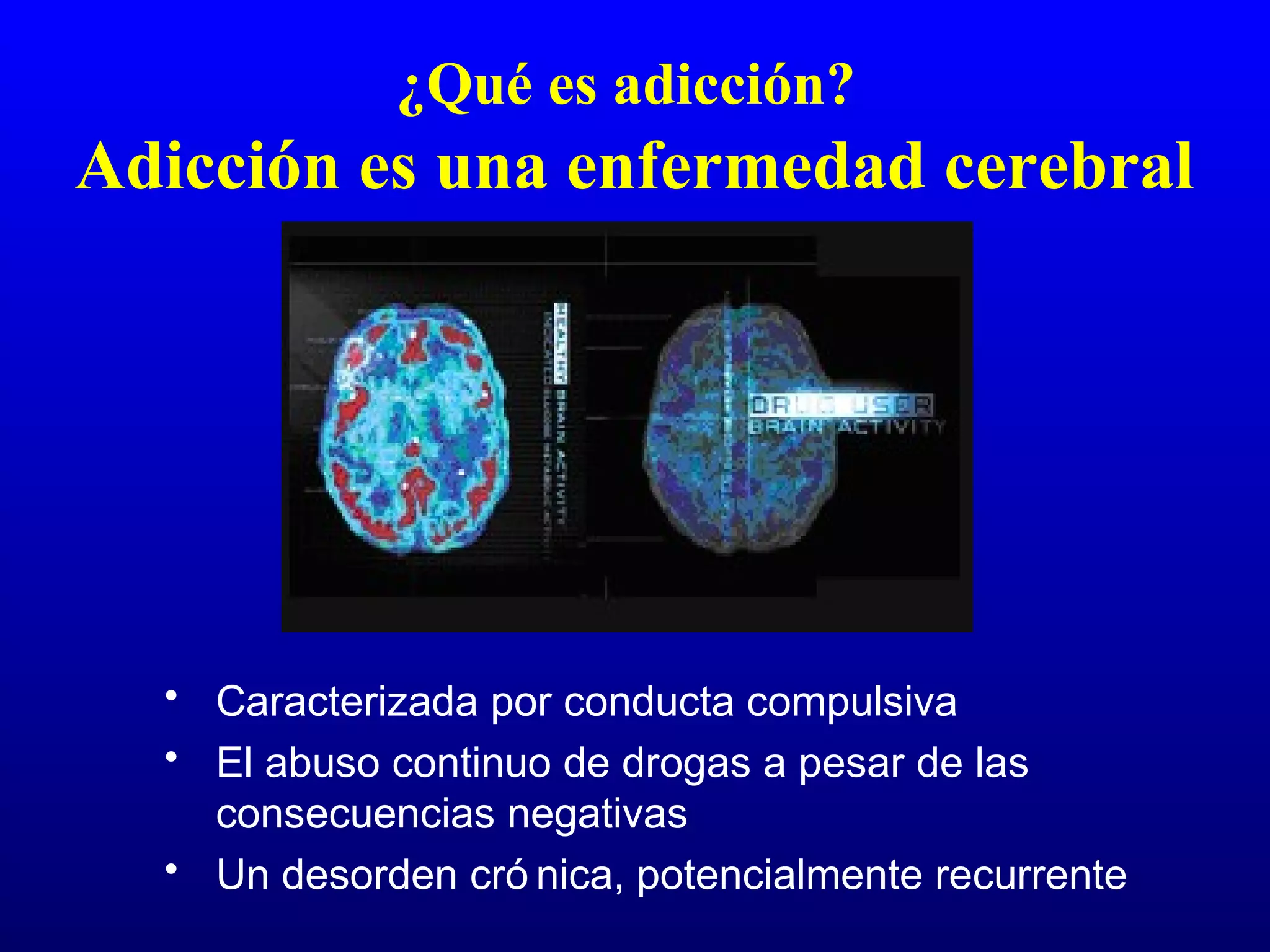 Adicción, una enfermedad cerebral. | PPT