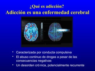 Adicción, una enfermedad cerebral. | PPT