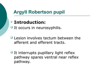 adie pupil and argyll robertson pupil.pptx