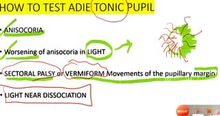 Adie Tonic Pupil 06 Nov 2022.pdf