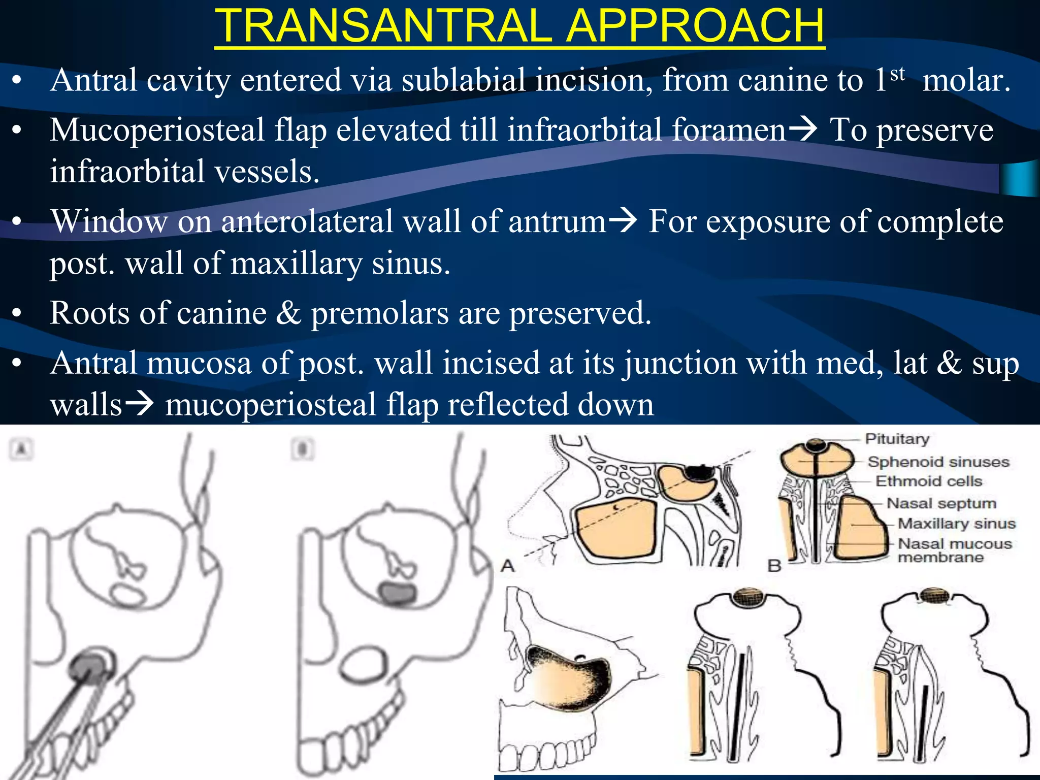 Surgical anatomy of Infratemporal fossa. by Dr. Aditya Tiwari | PPTX
