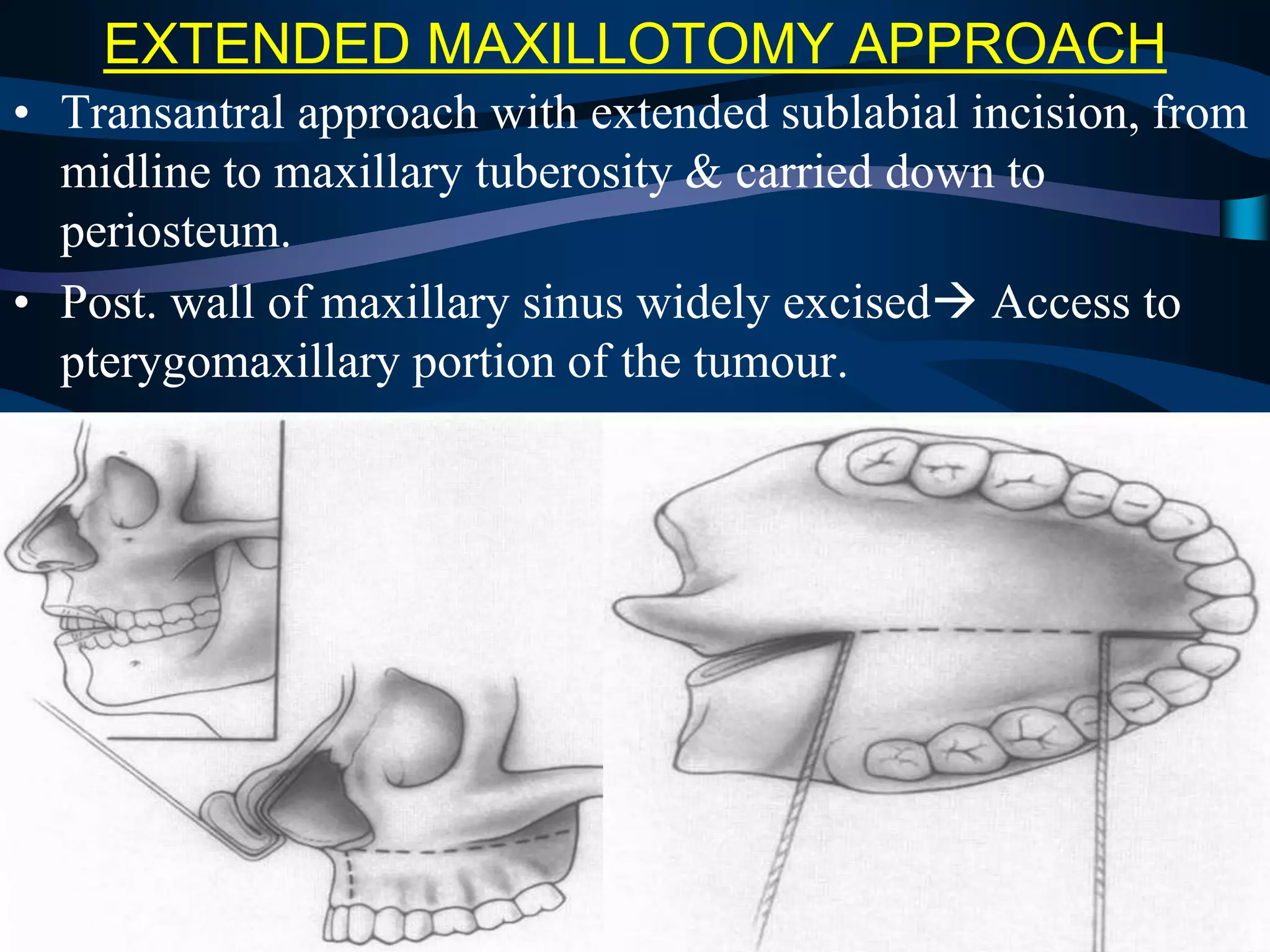 Surgical anatomy of Infratemporal fossa. by Dr. Aditya Tiwari | PPTX