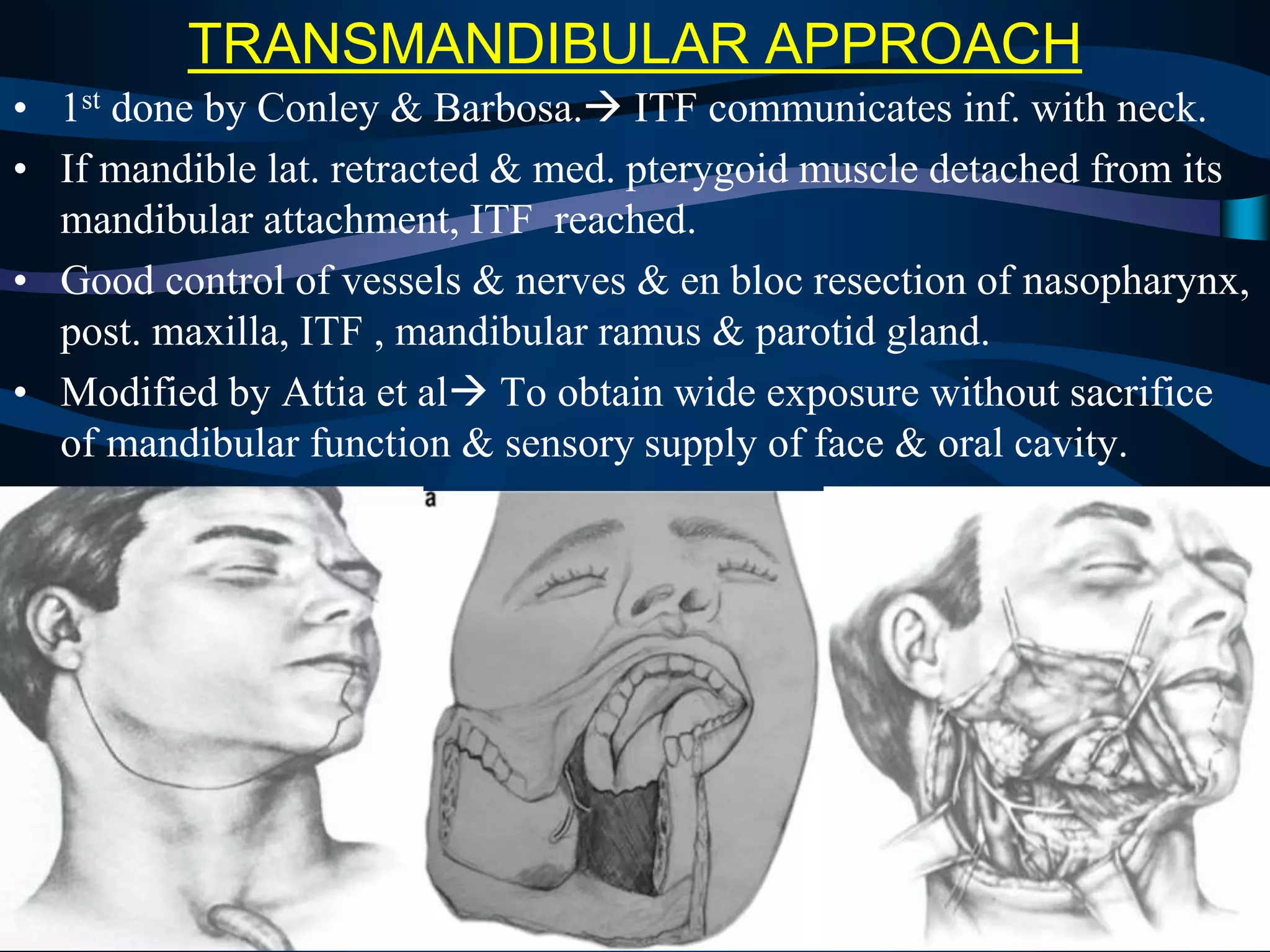 Surgical anatomy of Infratemporal fossa. by Dr. Aditya Tiwari | PPTX