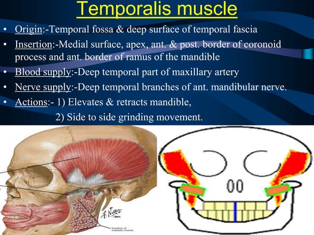 Surgical anatomy of Infratemporal fossa. by Dr. Aditya Tiwari | PPTX
