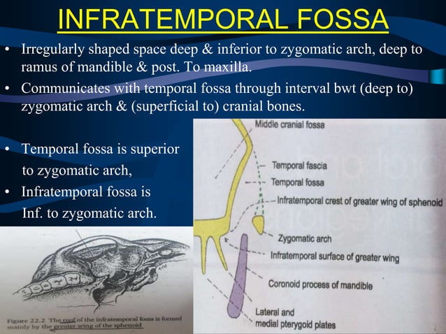 Surgical anatomy of Infratemporal fossa. by Dr. Aditya Tiwari | PPTX