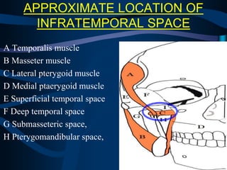 Surgical anatomy of Infratemporal fossa. by Dr. Aditya Tiwari | PPTX