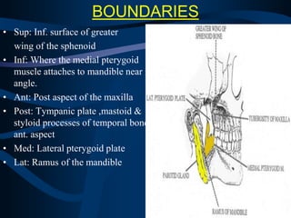 Infratemporal Fossa Boundaries