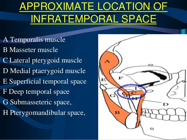 Surgical anatomy of Infratemporal fossa. by Dr. Aditya Tiwari