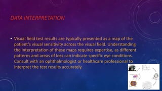 Adil Haque,59G-.Visual fields ( perimetry), Control Method.pptx