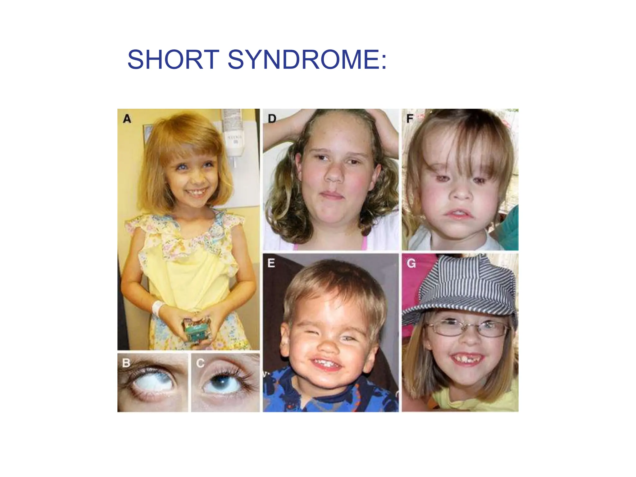Inherited defects of adipose tissue dermatology ppt | PPTX