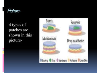 Transdermal Patches Of Drug Delivery System | PPTX