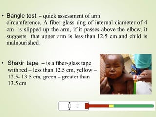 Techniques of anthropometric measurements in infants ppt medicine | PPTX