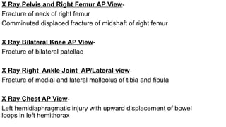 Radiological findings diaphragmatic injury | PPTX