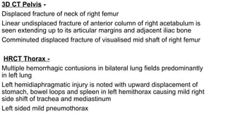 Radiological findings diaphragmatic injury | PPTX