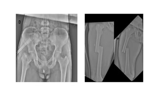 Radiological findings diaphragmatic injury | PPTX