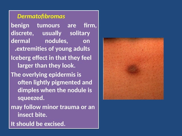 ADITYA 5B skin tumors. Skin tumor skin tumour | PPTX
