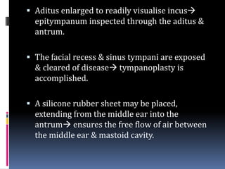 Facial Recess Approach