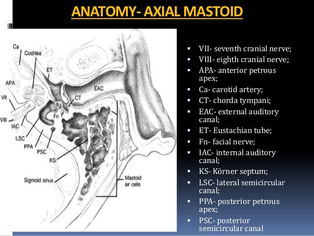 Canal wall up Mastoidectomy ( Intact Bridge Mastoidectomy) by Dr.Adit…
