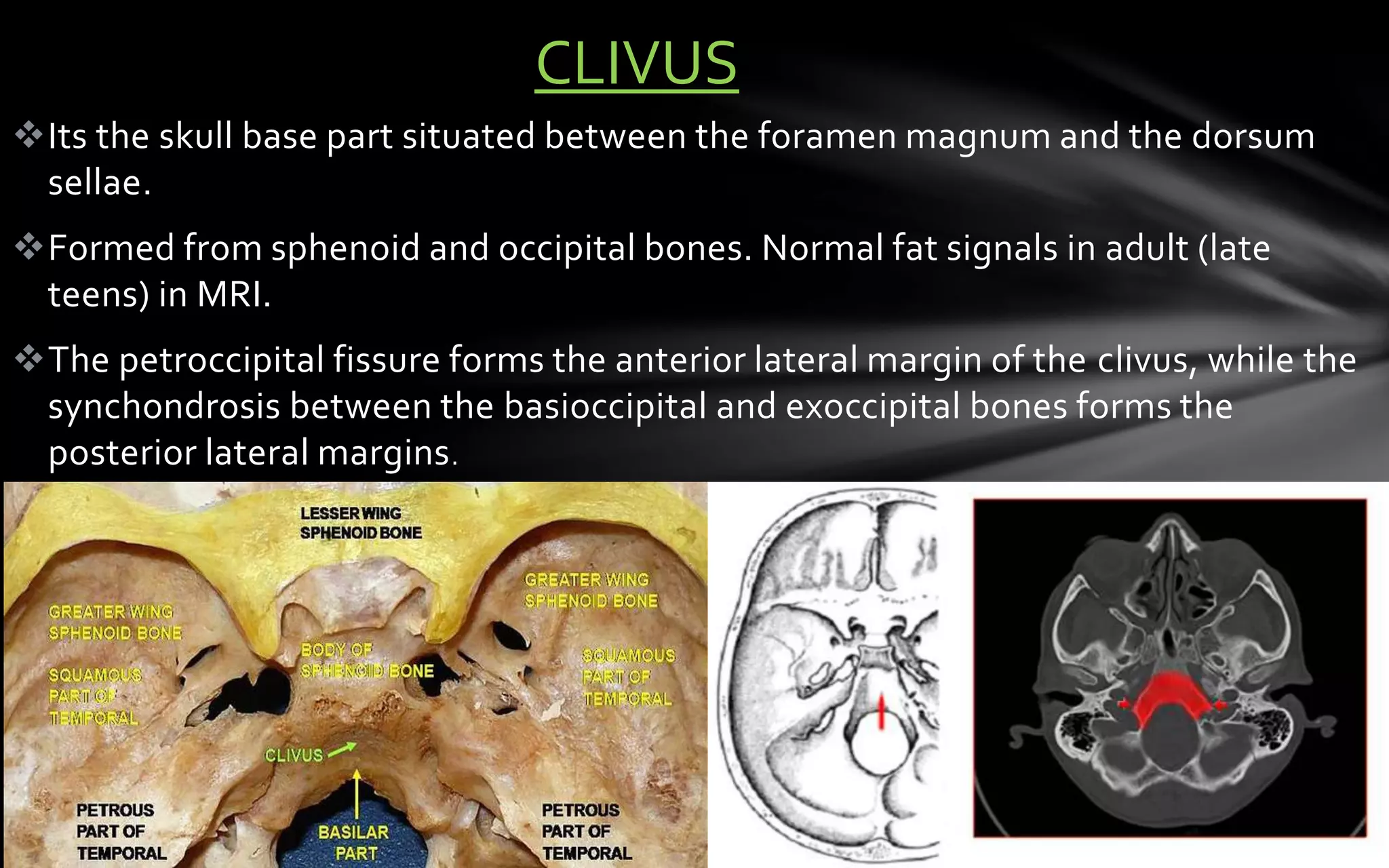 Skull base anatomy by Dr. Aditya Tiwari | PPTX
